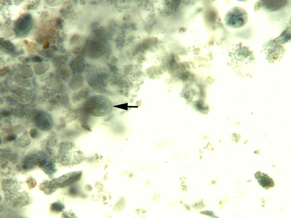 Giardia